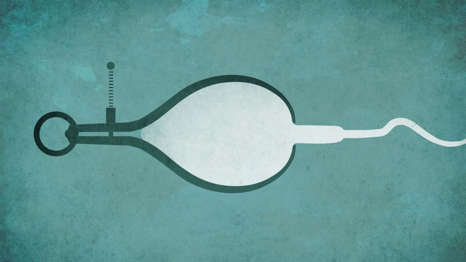 What is a Normal Sperm Count?